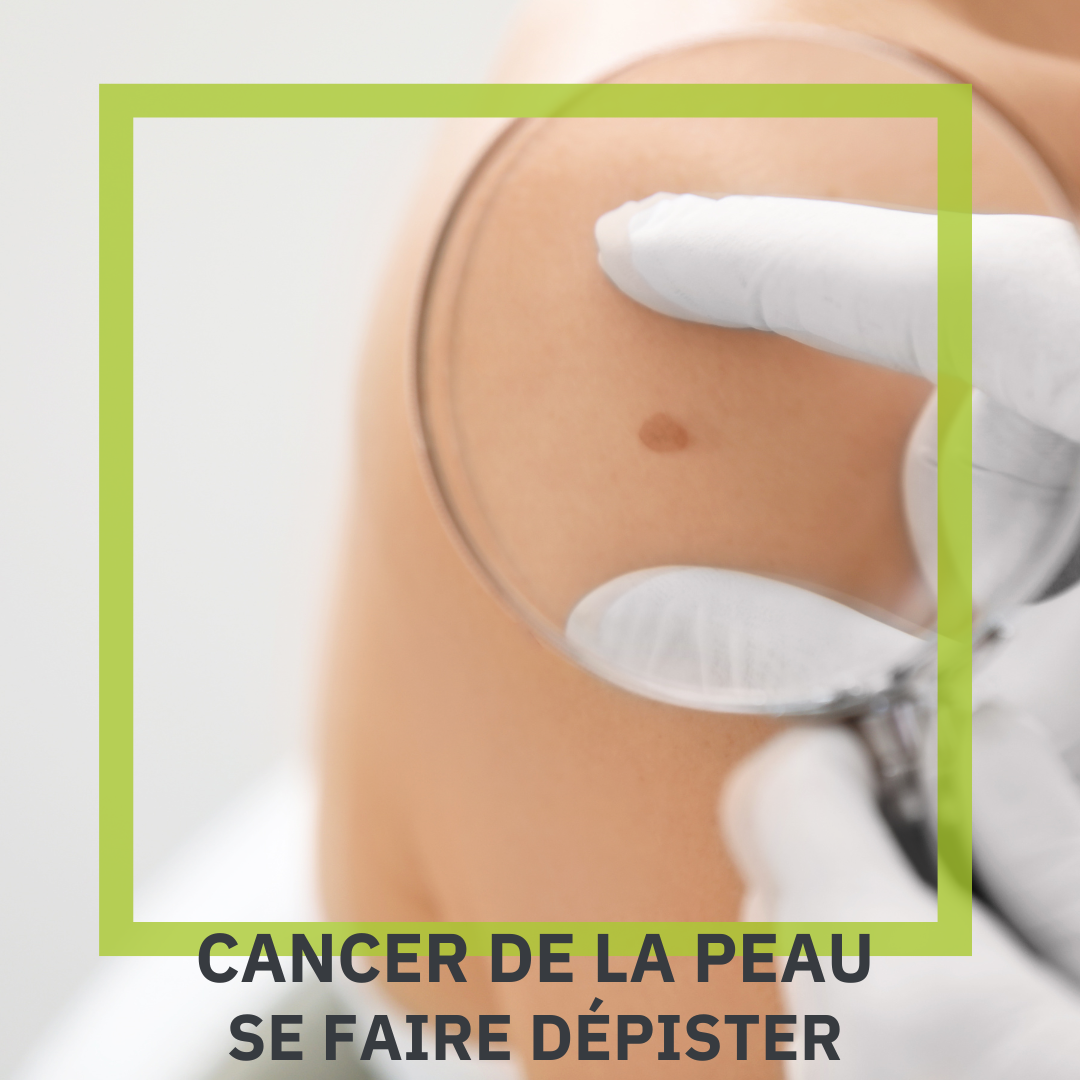 CANCER DE LA PEAU, PENSEZ À VOUS FAIRE DÉPISTER – Alternativ Pharma XV