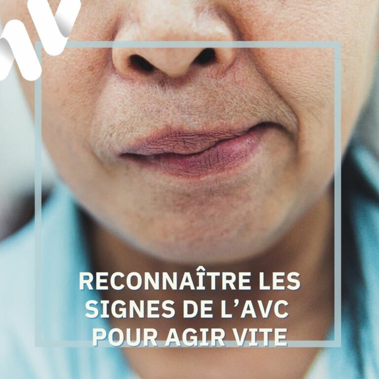 RECONNAÎTRE LES SIGNES DE L’AVC POUR AGIR VITE – Alternativ Pharma XV